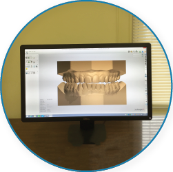 Digital Study Model - Bryn Mawr Orthodontic Laboratories, Inc.